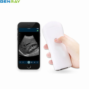 BR-US12 cheap price 10 inches full-digital portable ultrasound multi ...